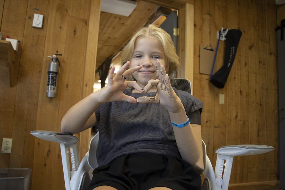 Possibilities Through Prosthetics